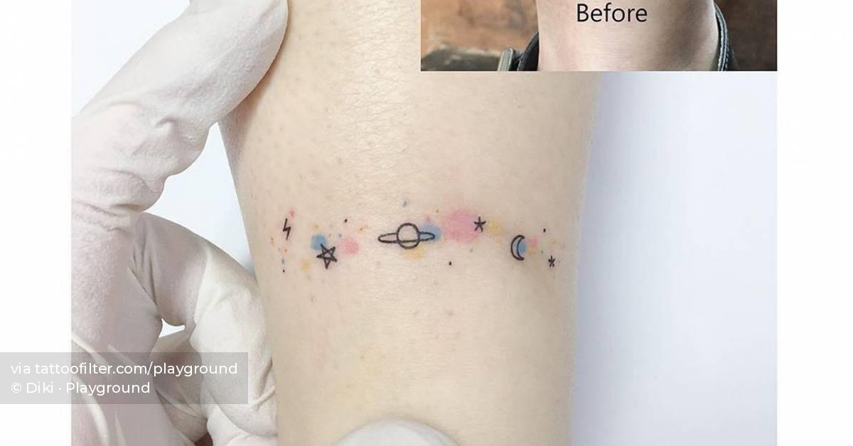 Universe tattoo covering up a scar.