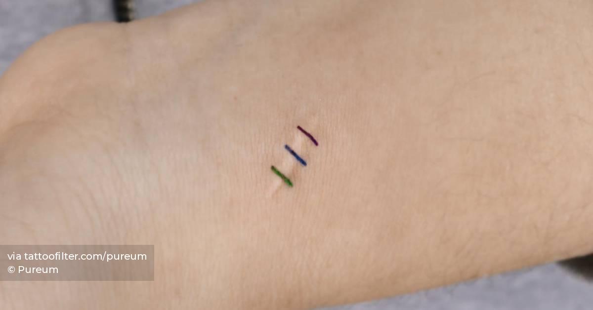 Minimalistic lines tattooed over the scar.