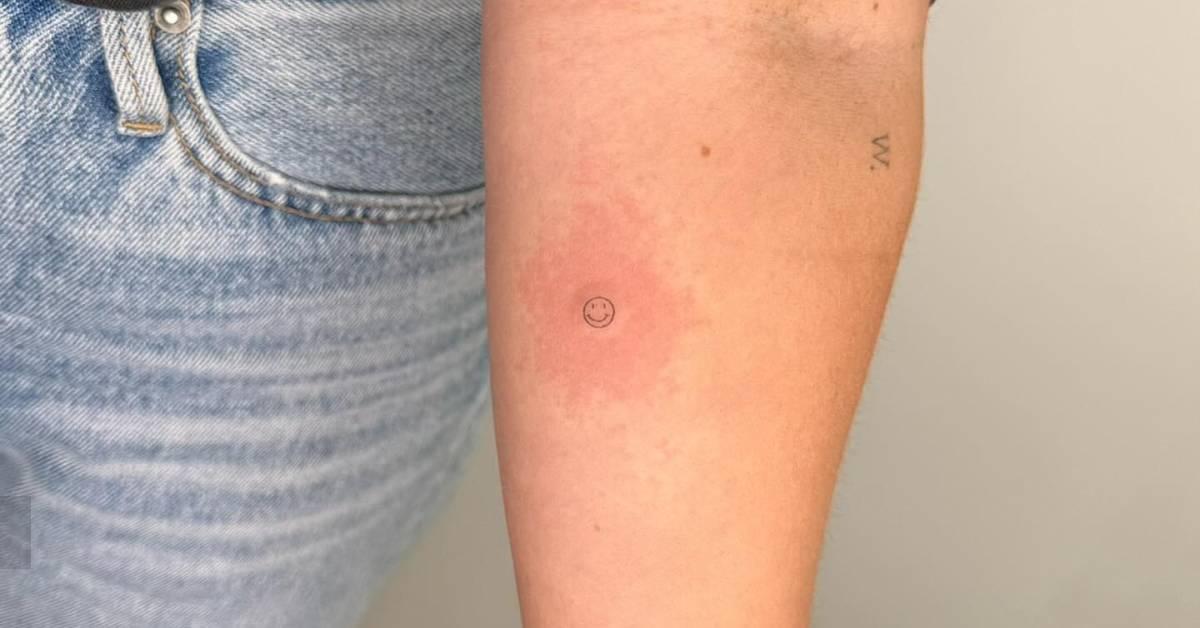 Micro smiley face tattoo located on the inner forearm,