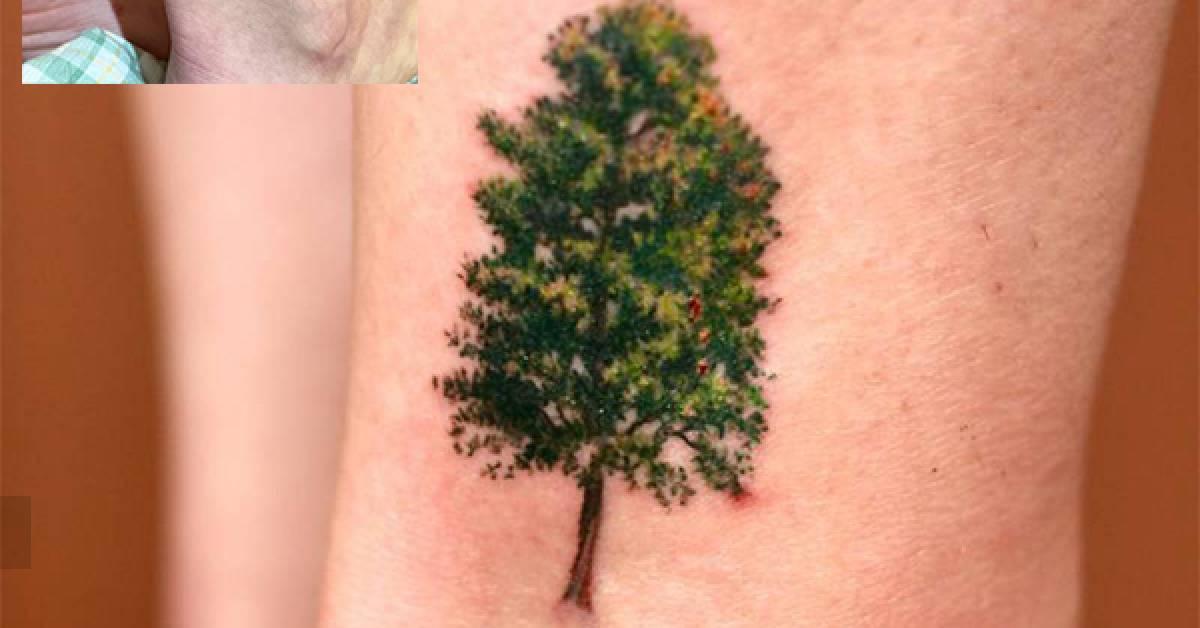 Watercolor style pine tree cover-up tattoo located on