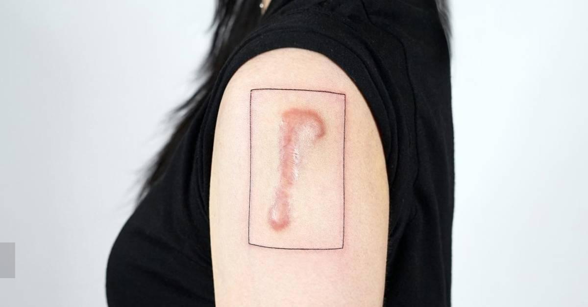 Rectangle scar cover-up tattoo located on the upper